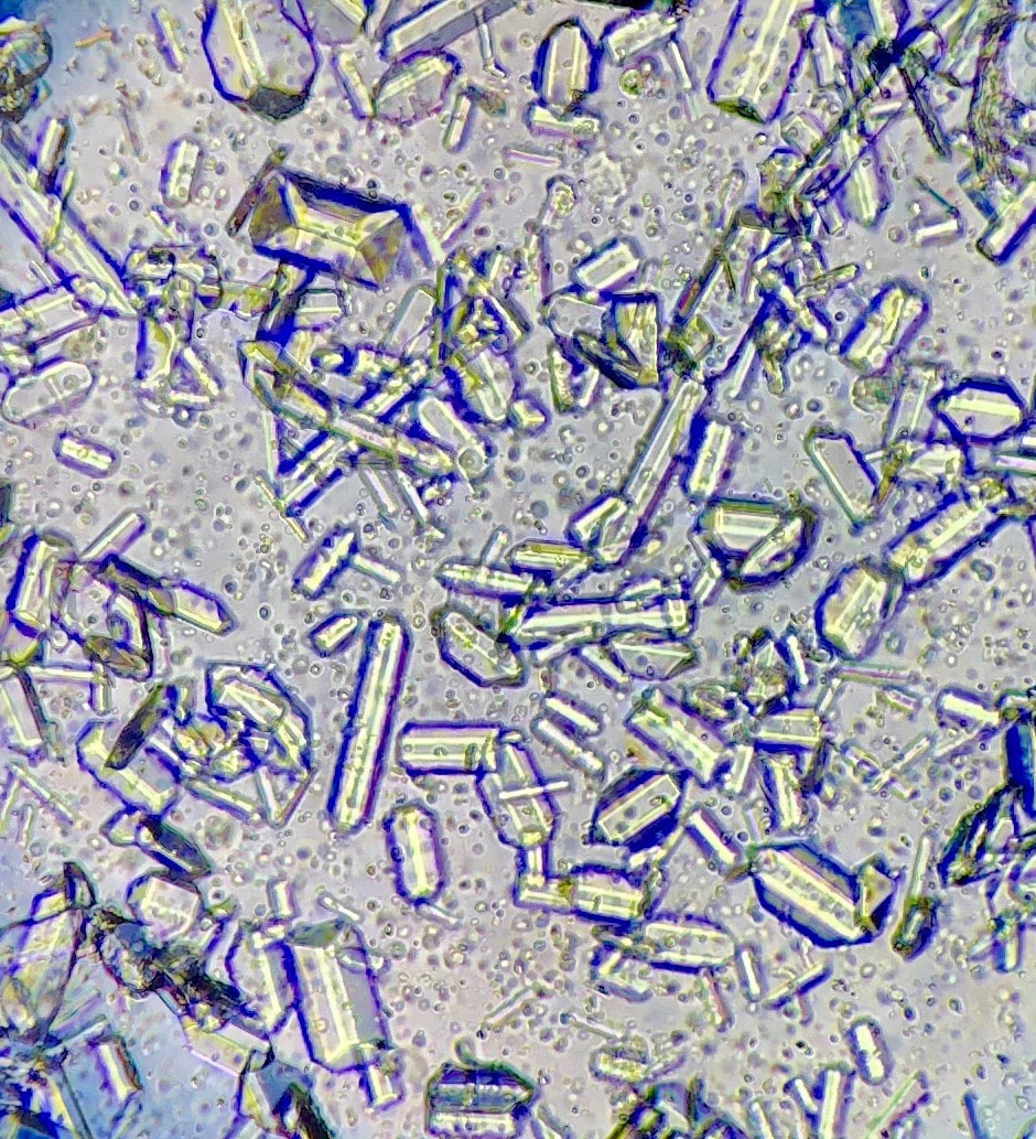 Struvite Crystals | Affordable Pet Care